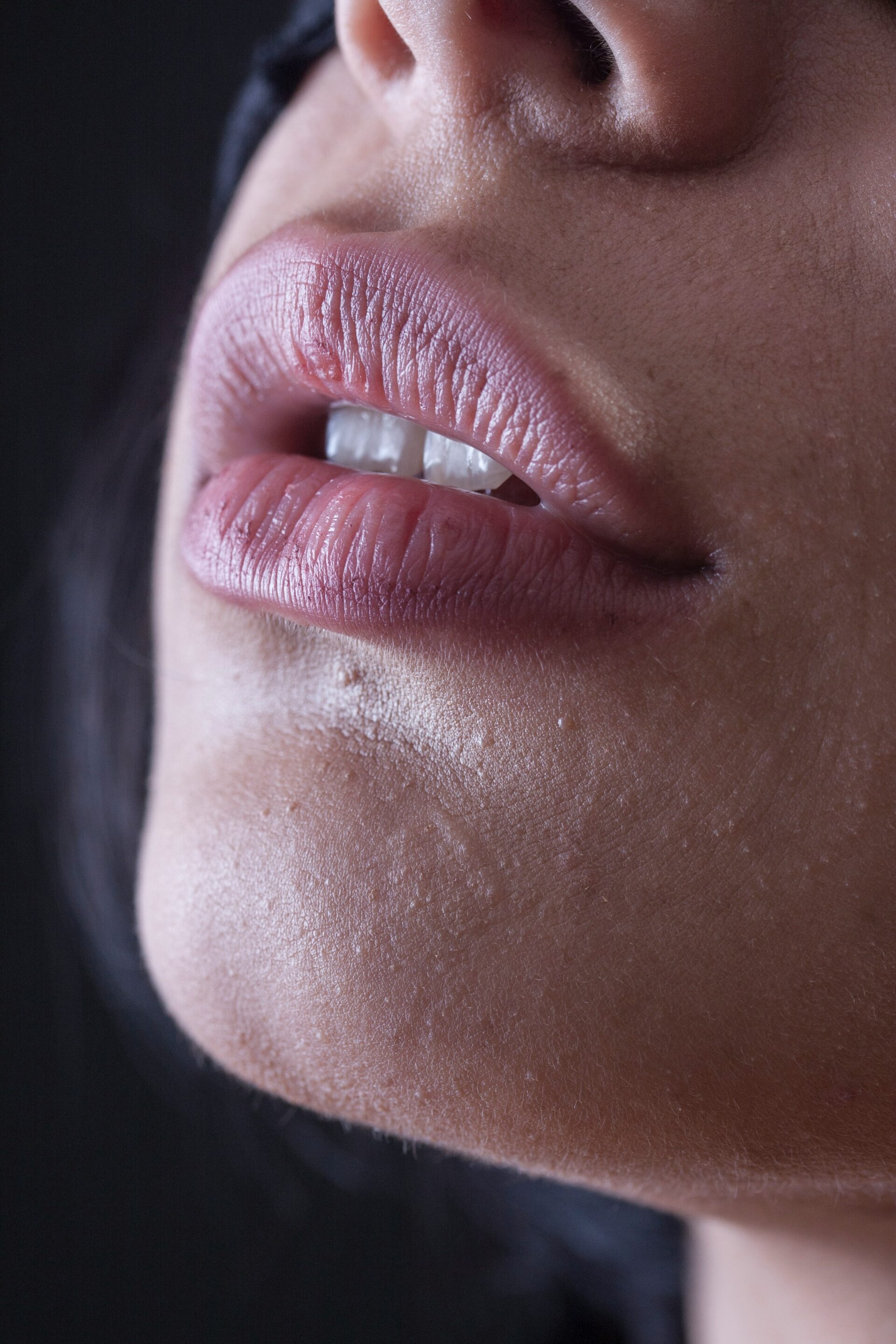 What Does An Aesthetic Doctor Do? - My Blog